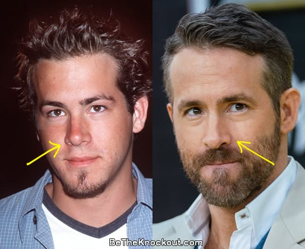 Ryan Reynolds Hairline