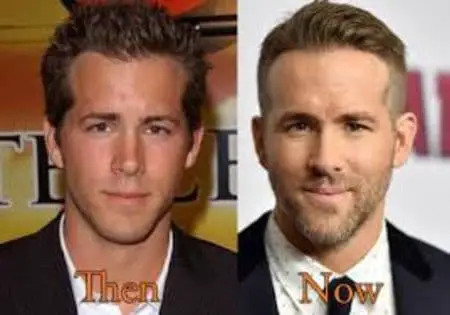 Ryan Reynolds Before And After