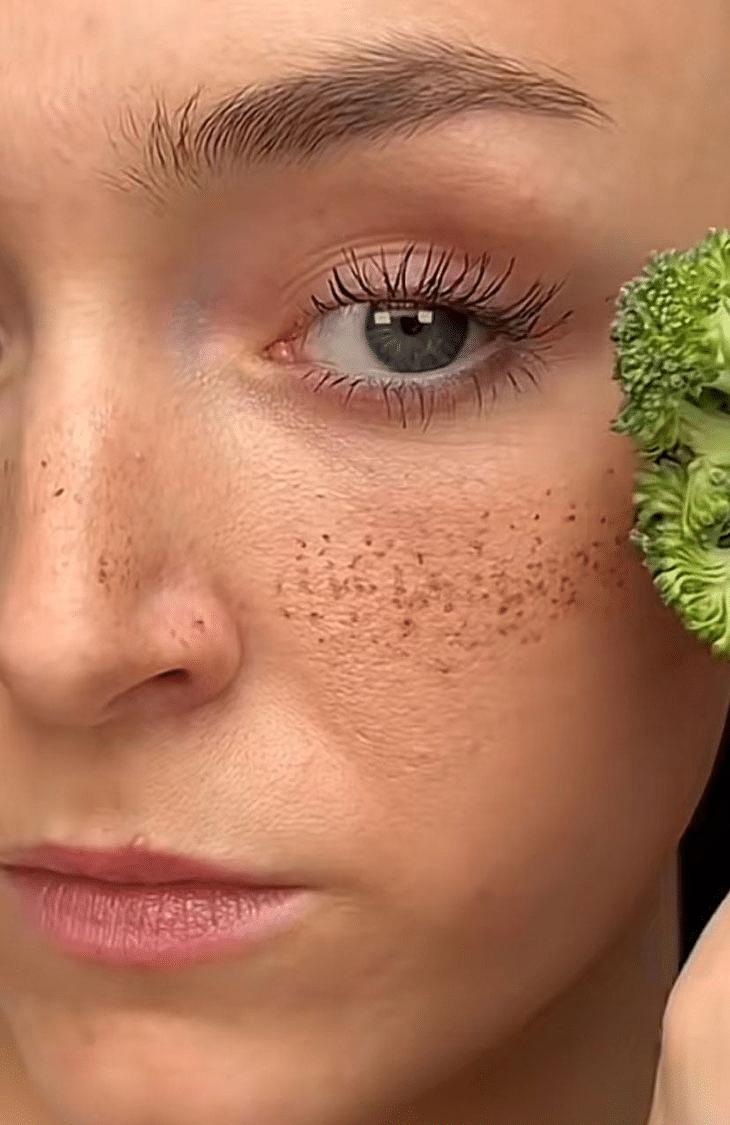 Get your freckles on: 3 Fun ways to rock faux freckles using Broccoli ...