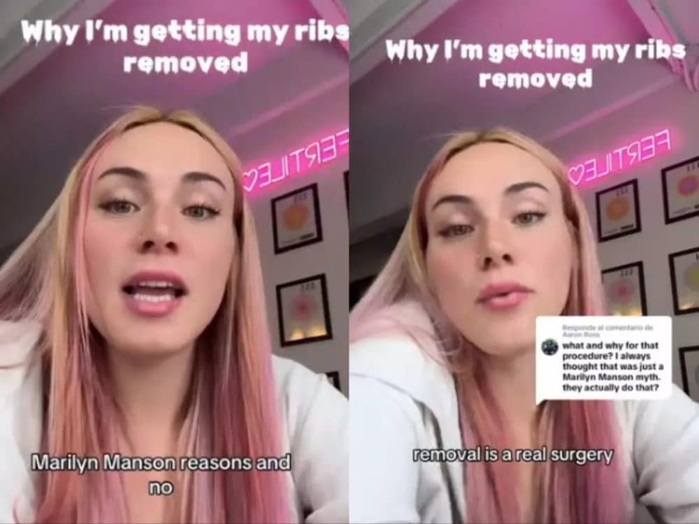 Influencer Emily James spends a huge amount to remove her ribs, wants ...