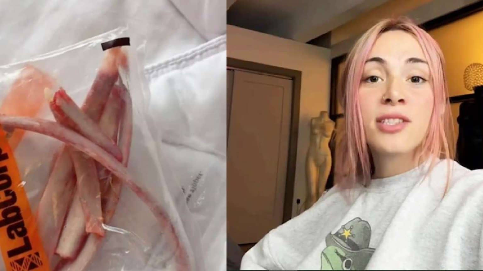 Influencer Emily James spends a huge amount to remove her ribs, wants ...