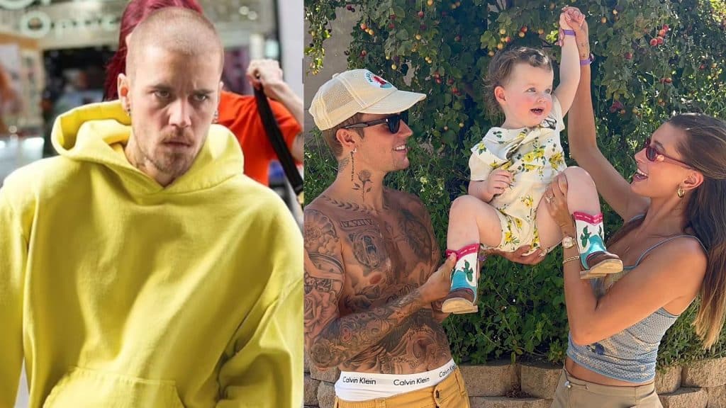 Justin Bieber receives support from fans after his hollow-eyed photos ...