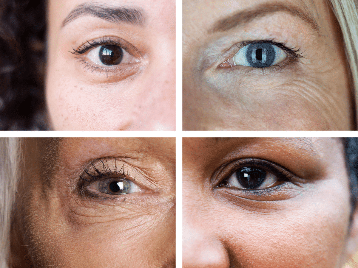Why moisturizing under-eye skin matters: Easy tips to reduce dark ...